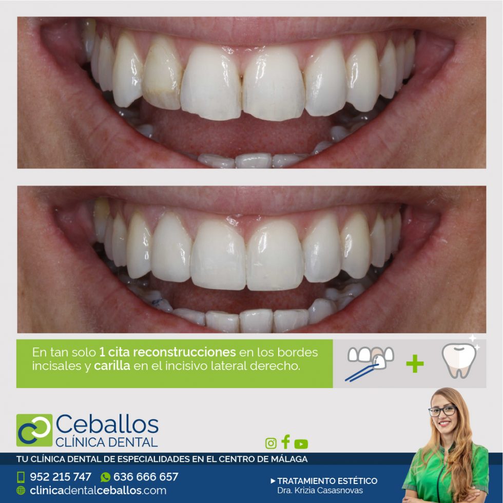 Nuestros pacientes en las redes sociales - Clínica Dental Ceballos